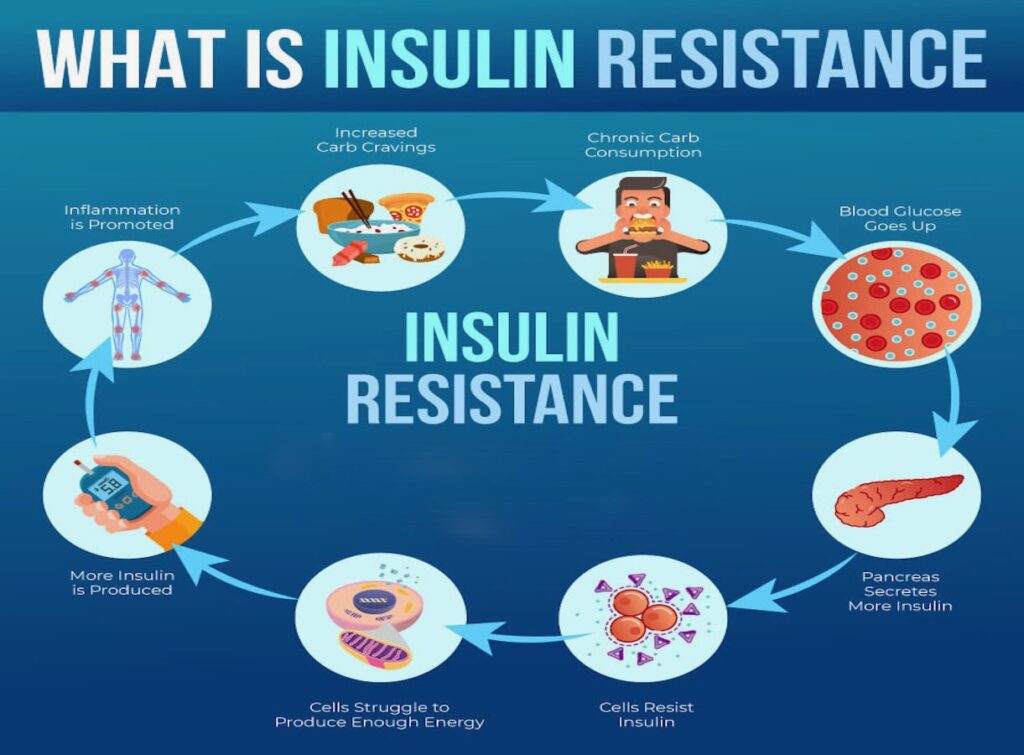 Insulin Resistance - Causes and Control - Dr Carolyn Dean MD ND